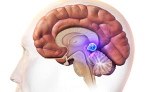 Glândula Pineal | Epífise | Anatomia, Histologia e Função | Resumo