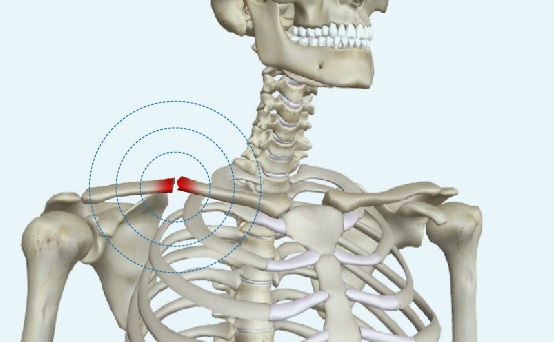 Clavícula | Anatomia | Função | Regeneração de Clavícula Quebrada